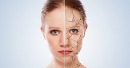 Piel Seca y Escamosa Cómo Evitarlo