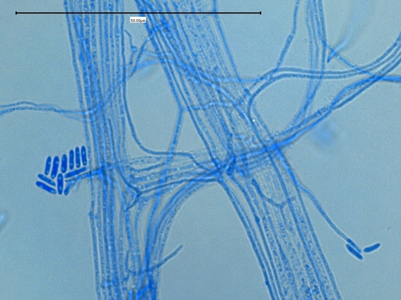 Fun With Microbiology (What's Buggin' You?): Sarocladium kiliense