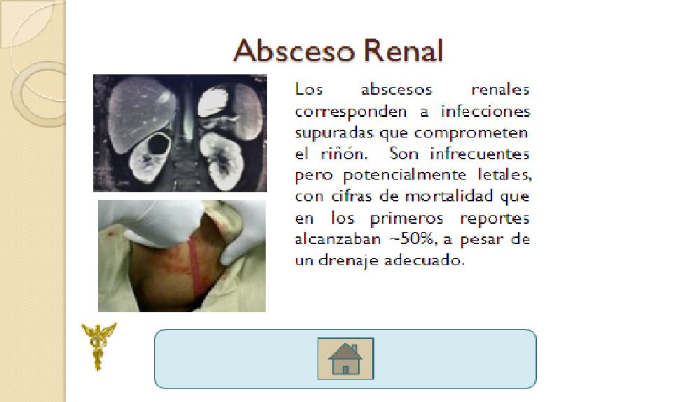 Absceso Renal: Absceso Renal
