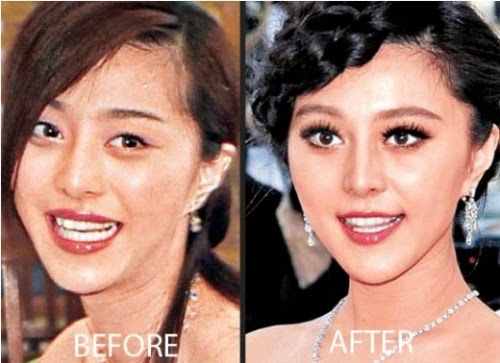 Fan Bing Bing Plastic Surgery Nose Job, Chin Implants Before and After ...