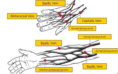 Mata Kuliah Kebidanan: Macam-macam vena untuk pemasangan infus