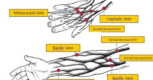 Mata Kuliah Kebidanan: Macam-macam vena untuk pemasangan infus