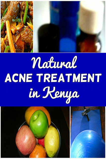 Acne Treatment in Kenya