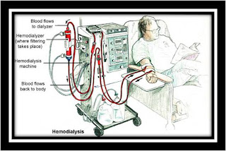 Dialisis ~ Generasi Kimia Indonesia
