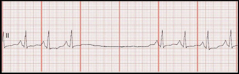 Basic EKG Rhythm Test 09