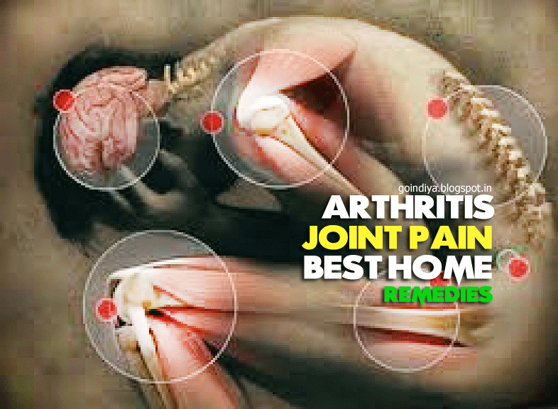 Arthritis & Joint Pain - 13 Best Natural Home Remedies - 2 - Natural Home Remedies. Simple and ...