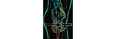 布魯斯運動教室: 什麼是關節中心化(Joint centration)?