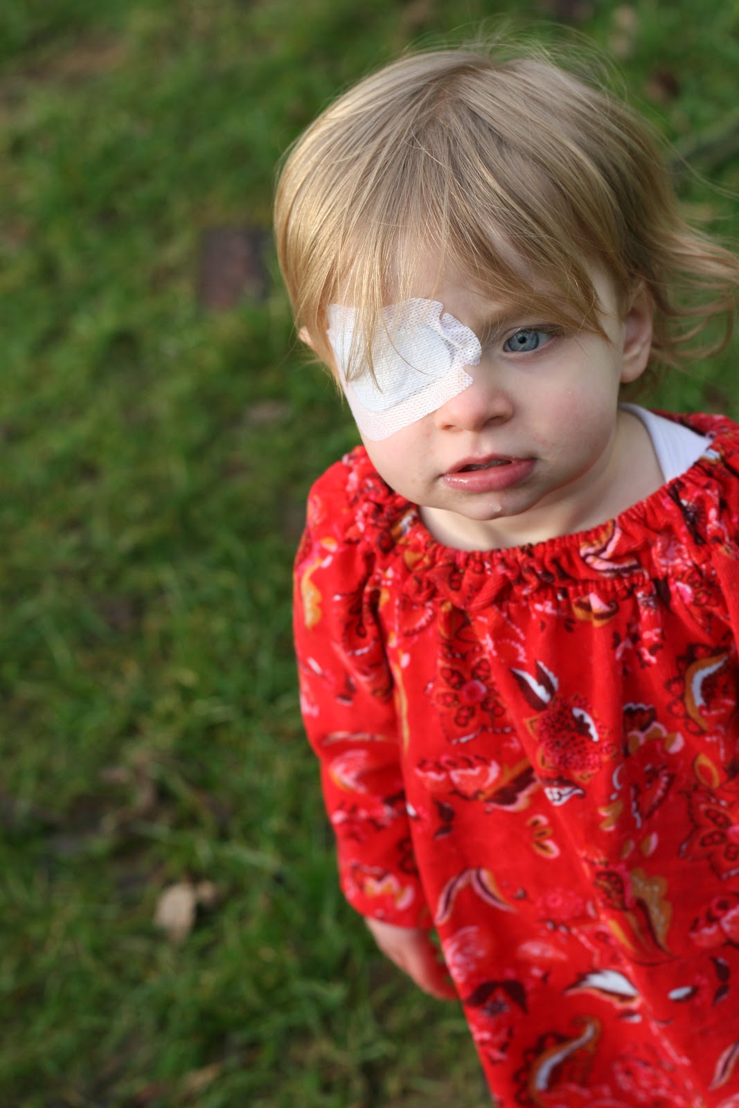 oldpolicehouse: The story of a wonky eye