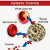 Altered Tissue Perfusion related to Pancytopenia - Nursing Care Plan