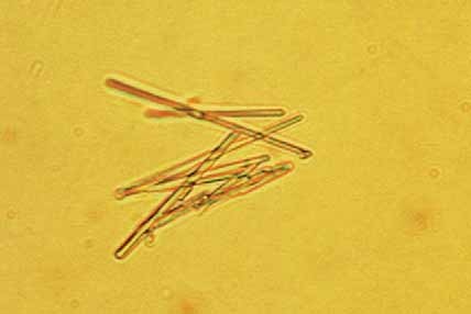 [Haematology] Microscopic Examination of Urinary Sediment - Crystals ...