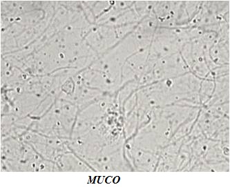 Aprendendo Saúde - 2012: UROANÁLISE