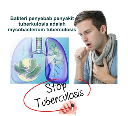 Paket herbal Obat sakit batuk tbc di apotik