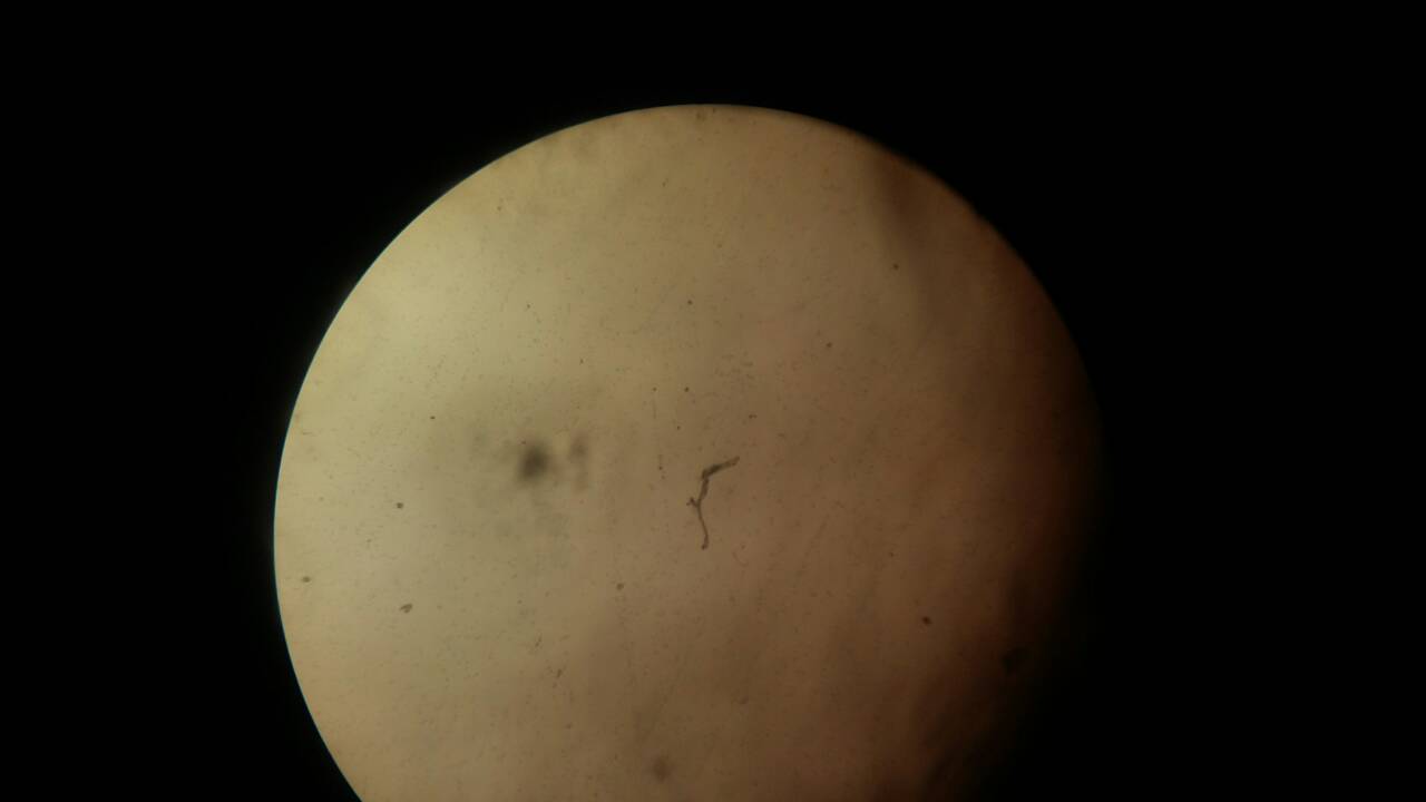 PEMERIKSAAN TELUR CACING PARASIT PADA FESES (METODE APUNG DENGAN DAN ...