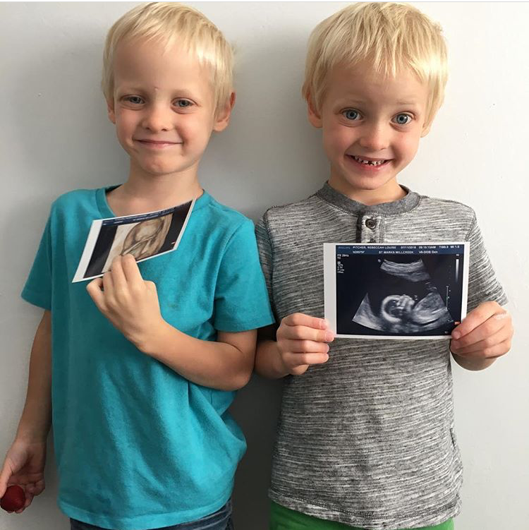 Little Pitchers: Louise Mae (part 1- pregnancy)