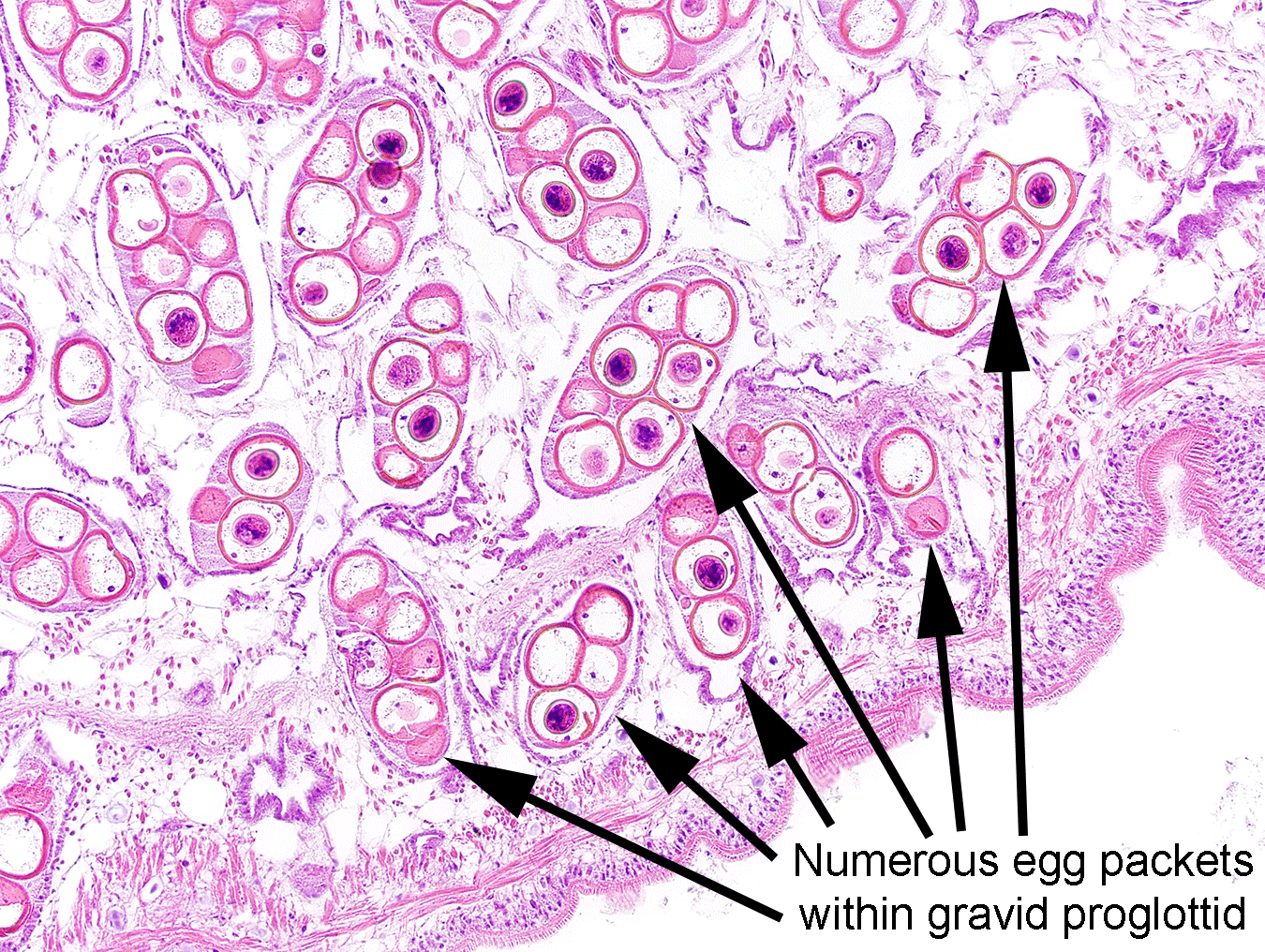 Gravid Proglottid Eggs