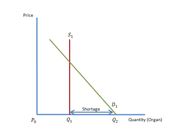 Economists in The Making: Market for Human Organs