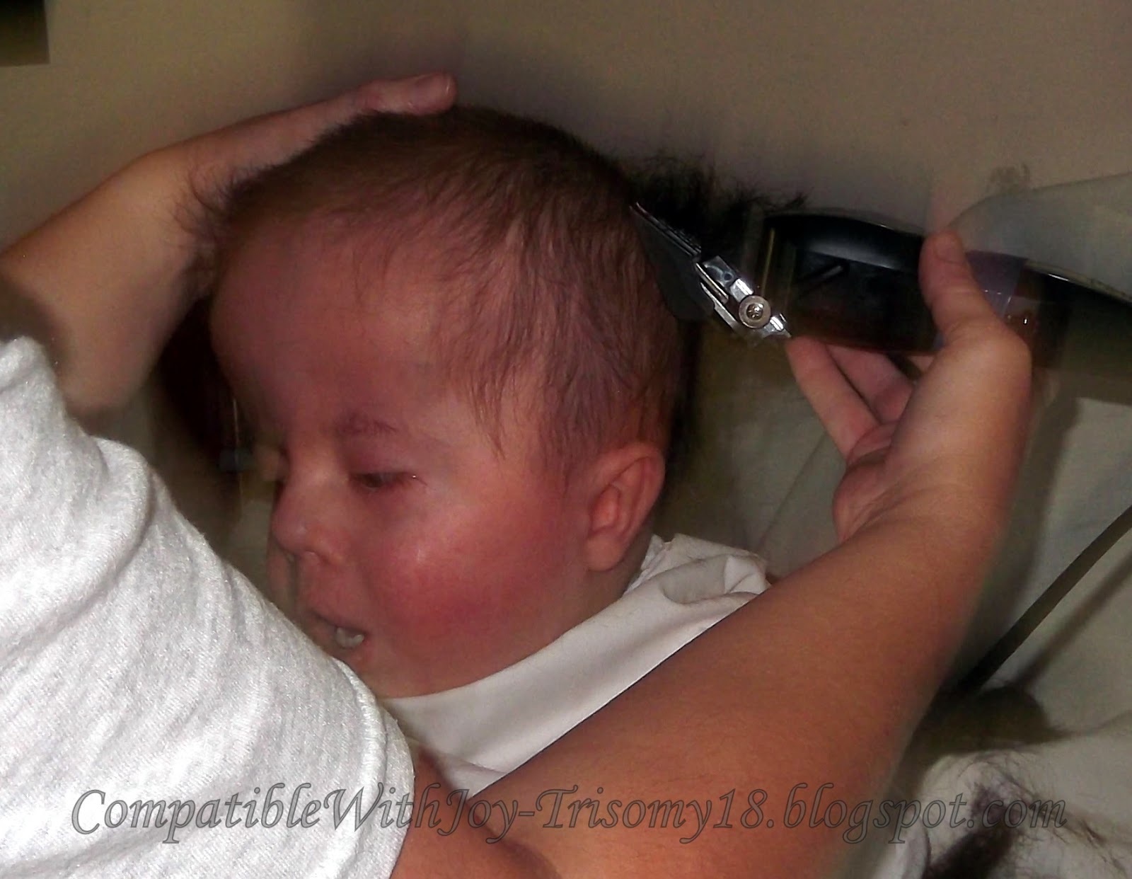 Compatible With Joy-Trisomy18: 09/01/2013 - 10/01/2013