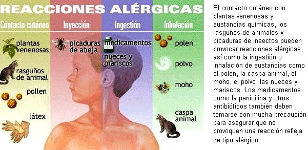 ALERGIAS