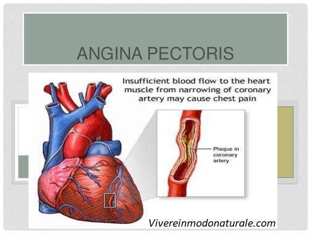 Vivere in modo naturale: Rimedi naturali per l'angina pectoris, il dolore al petto.