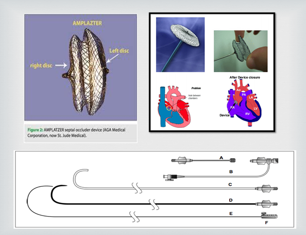 Pelangi Kehidupan: Asuhan Keperawatan Pada Pasien Dengan ASO ...