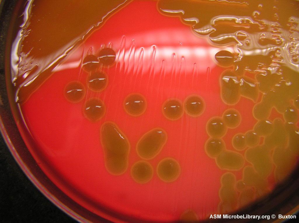 Pendidikan/ Kesehatan: Pneumococcus sp.
