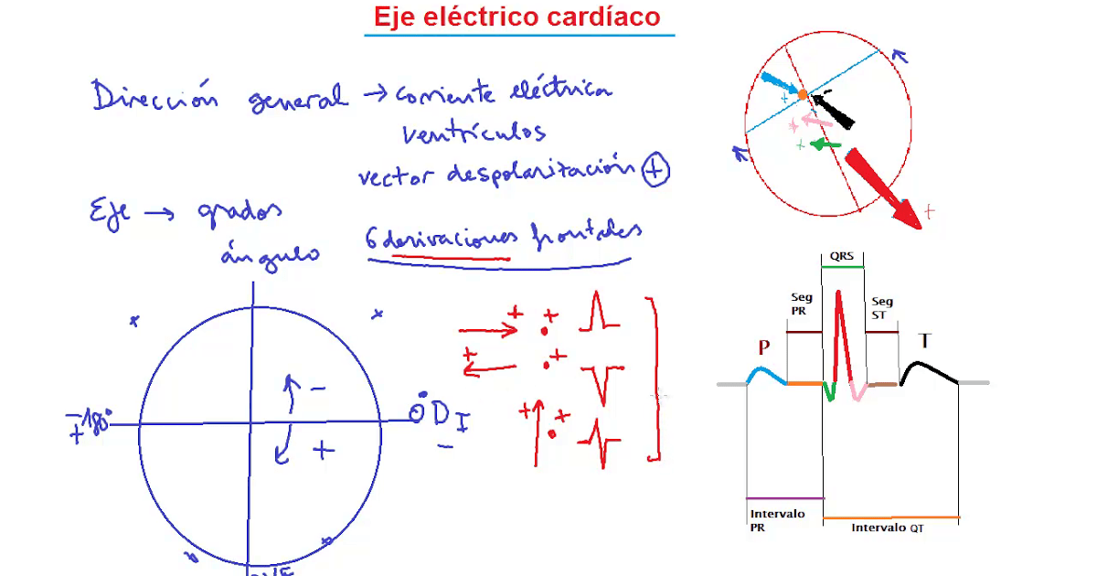 EKG normal (14): Eje eléctrico cardíaco | Dr. Alberto Sanagustín