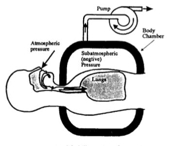 Treatment Equipment: Mechanical Ventilator