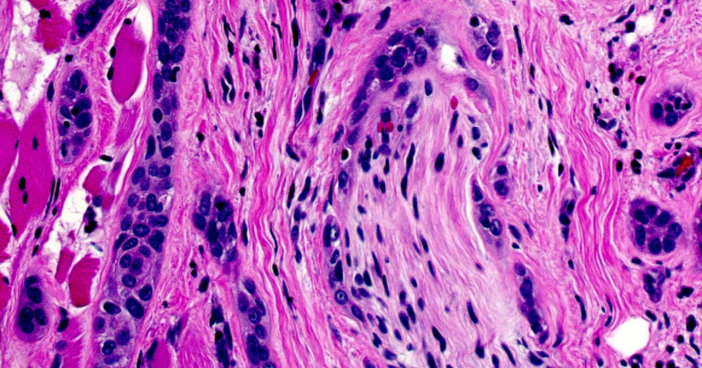Microscope World Blog: Digital Pathology Microscope Cameras