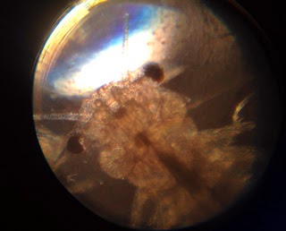 Microscope photographs | Stars, Genes And Quarks