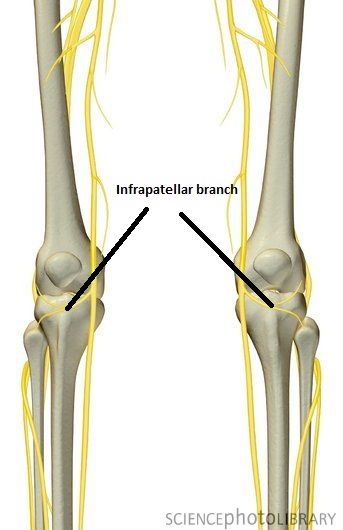 My Bilateral Total Knee Replacement And Addiction Experiences: NUMBNESS