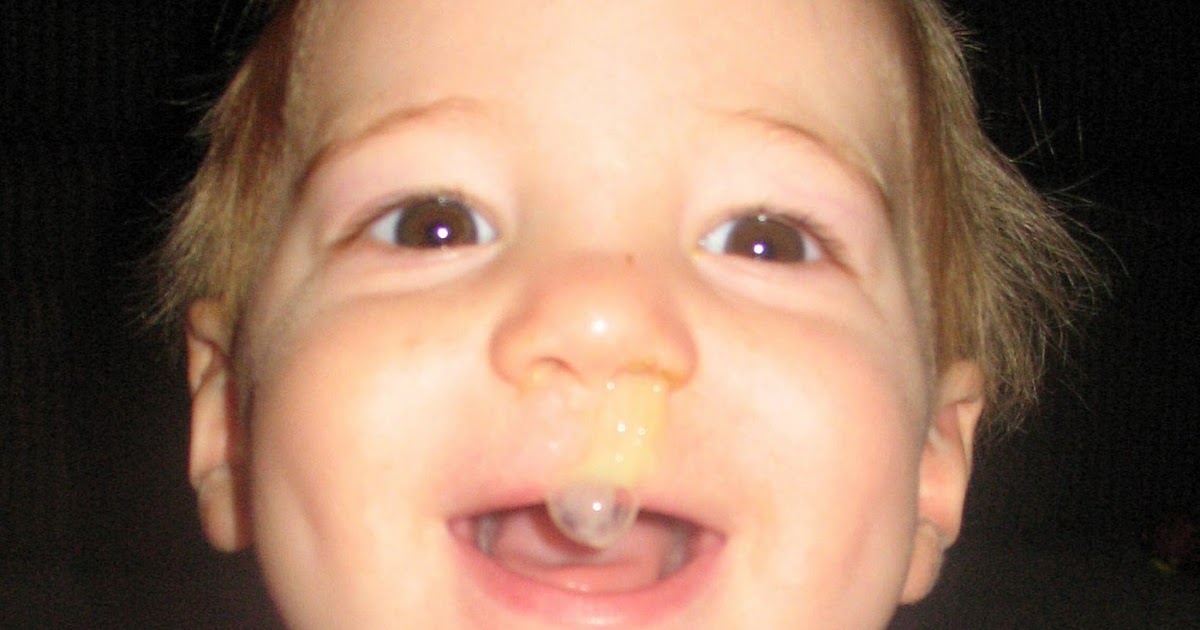 French Vocabulary Illustrated: morveux