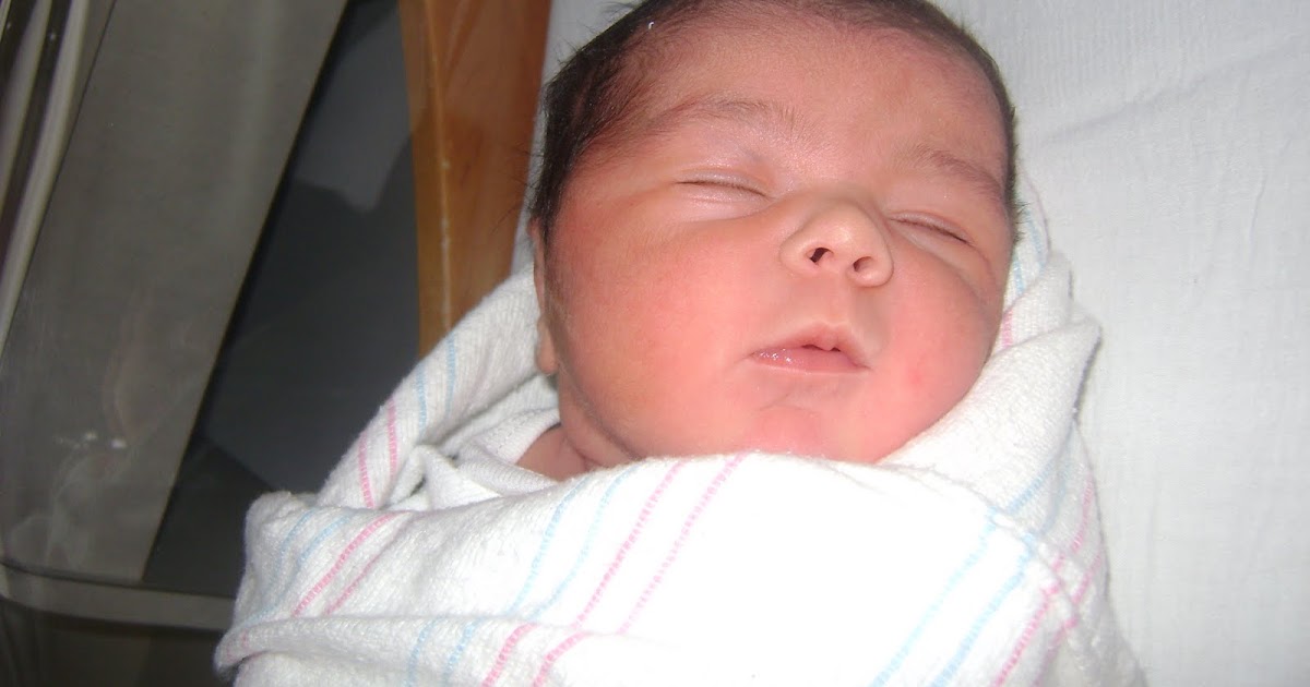 Yeso tipo espica (spica cast)