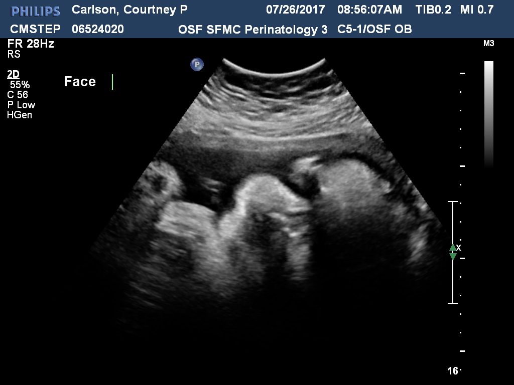 Here I am: 37 Week Sonogram and My Happy Baby