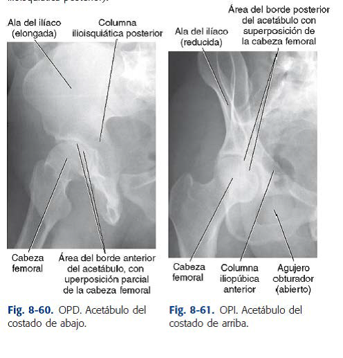PRODUCCION Y TRATAMIENTO DE IMAGENES DIAGNOSTICAS: CAPITULO FEMUR Y ...