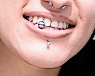 Common Dental Problem And Solution: Oral Piercing