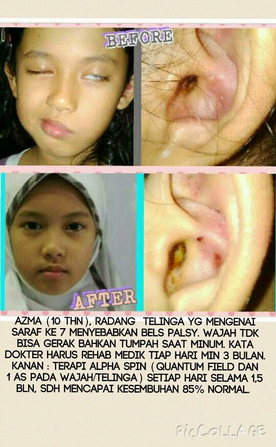 Alpha spin and alphameta testimony.: May 2015