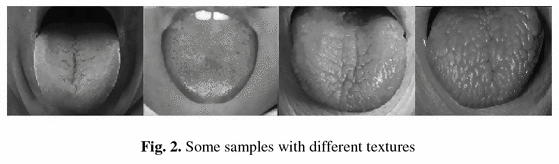 Tahukah Anda Lidah Dapat Menjadi Alat Verifikasi Identitas Seperti ...