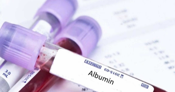 الالبومين Albumin