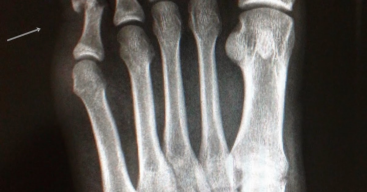 DICAS DE RADIOLOGIA - Tudo Sobre Radiologia: IMAGENS RADIOLÓGICAS ...