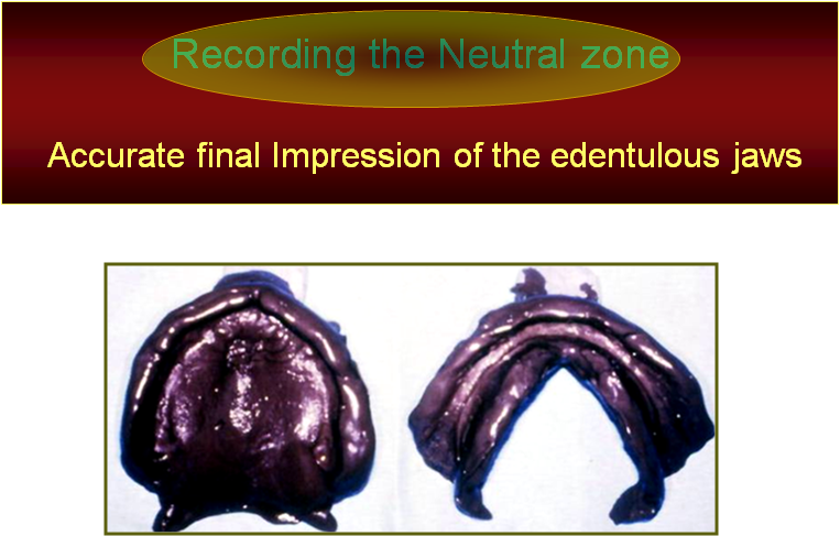 Dentistry and Medicine: Concept of Neutral Zone
