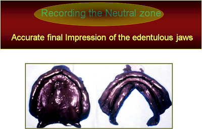 Dentistry and Medicine: Concept of Neutral Zone