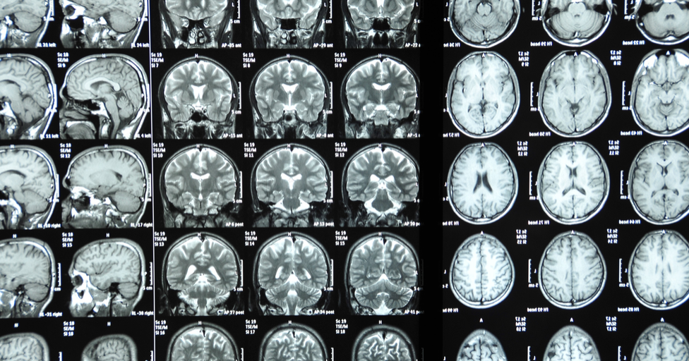 Real Psychiatry: Sedating Patients For Imaging Studies