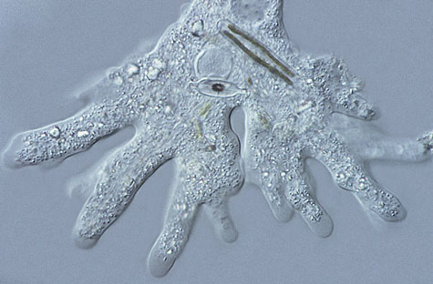 Learning_Bloggirl: Microscopy & Prokaryote