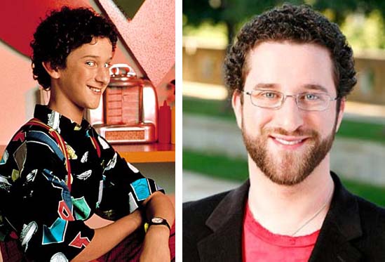 Dustin Diamond Plastic Surgery