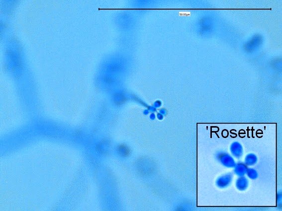 Fun With Microbiology (What's Buggin' You?): Sporothrix schenckii ...