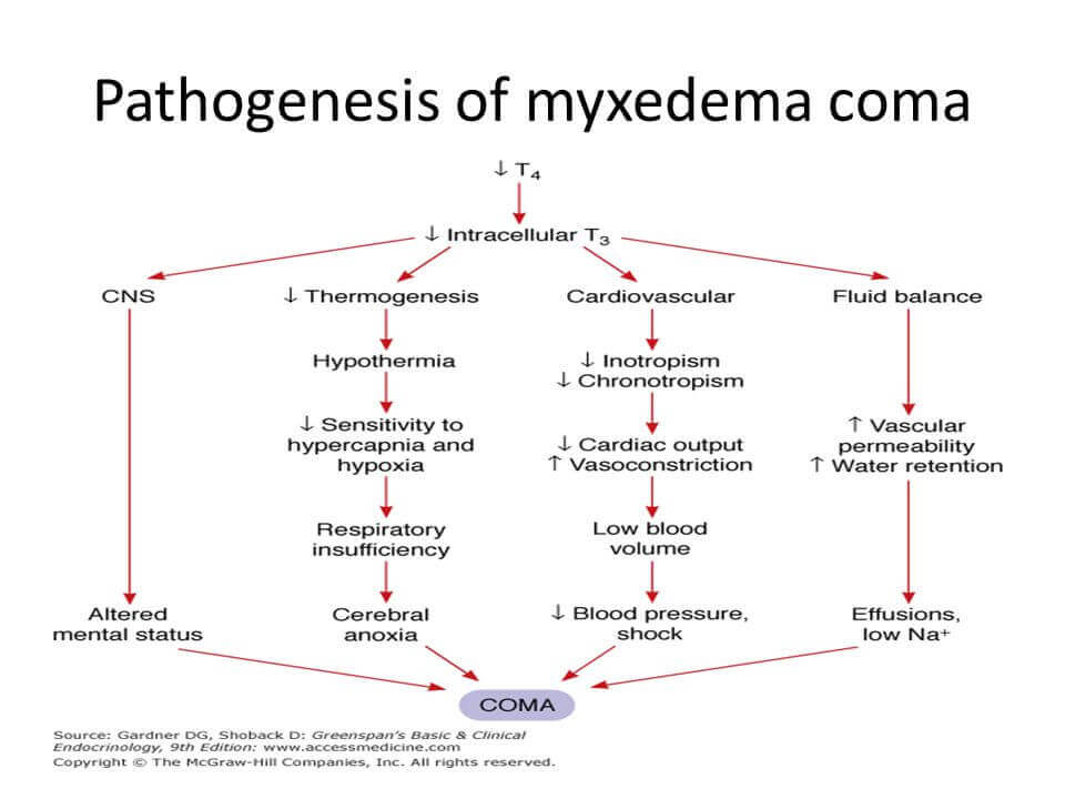 Myxedema Coma| definition, causes, symptoms, diagnosis and treatment