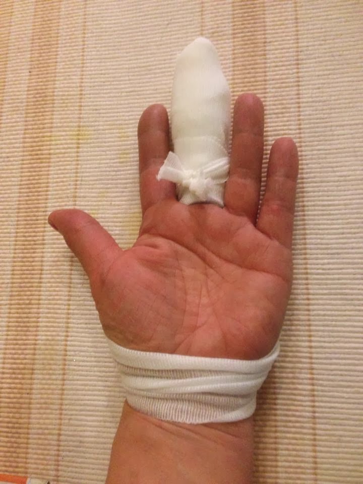 Hirnakan torppa: Missä on keskisormi?