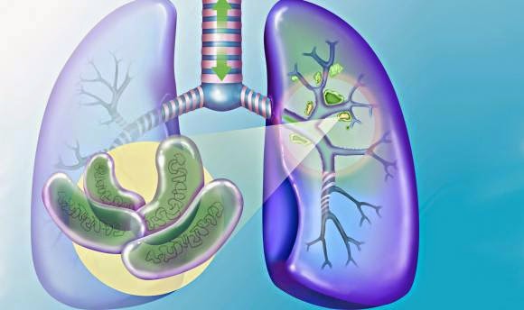 TU SALUD Y LA NUTRICIÓN.: Día Mundial de la Tuberculosis (TB).