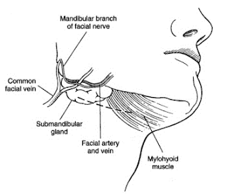 Dental Care: Submandibular Gland Resection