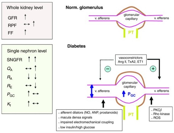 Kidney Disease Treatment www.kidney-support.org: Diabetes: Sudden GFR ...